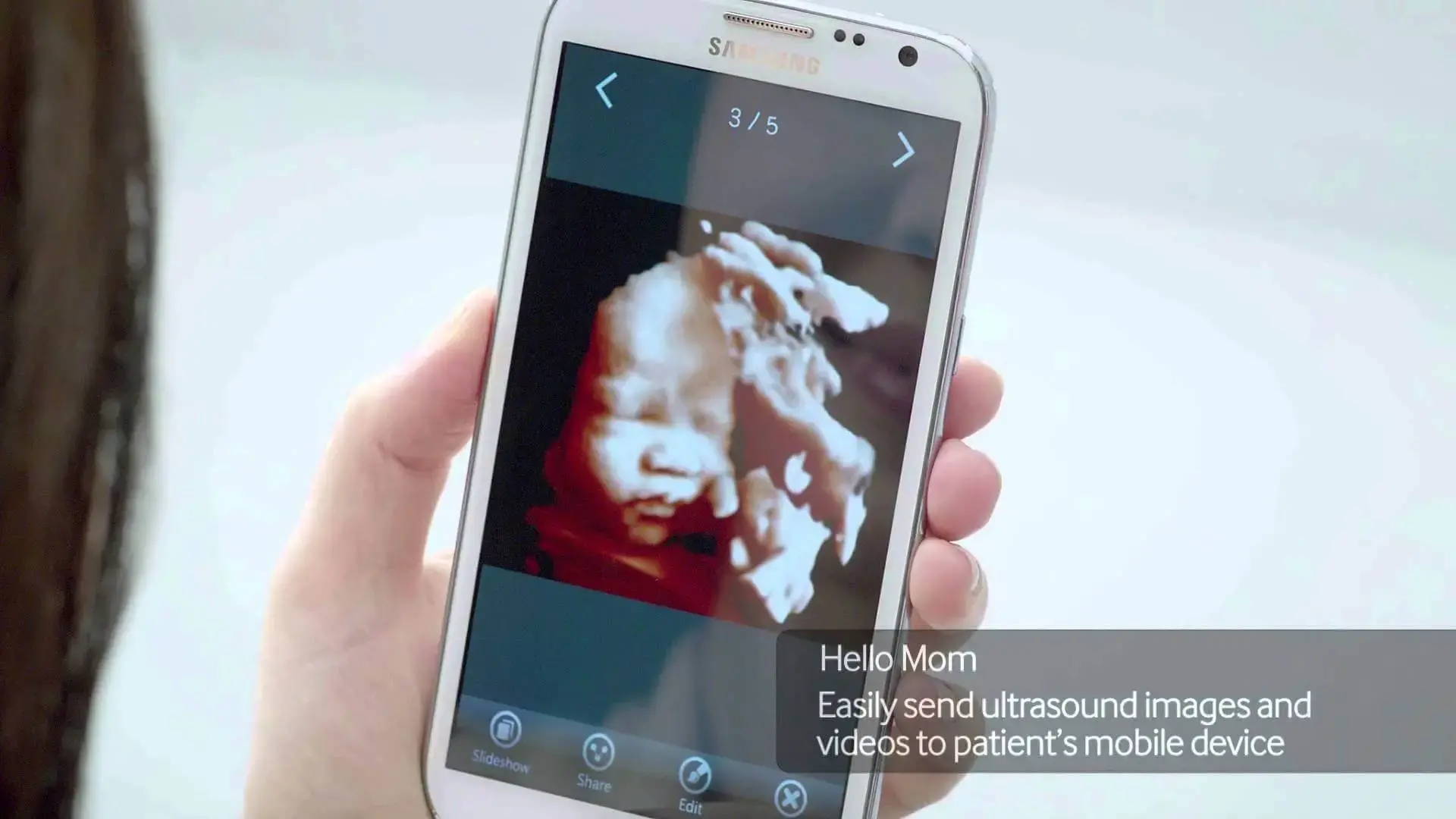 Hello Mom: aplicativo compartilha ultrassom do bebê em tempo real